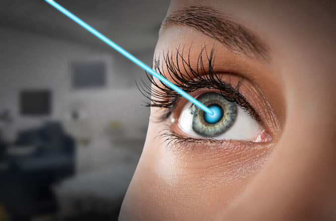 Why You Should Consider Laser Surgery Heal Myopia Visual Task Tips